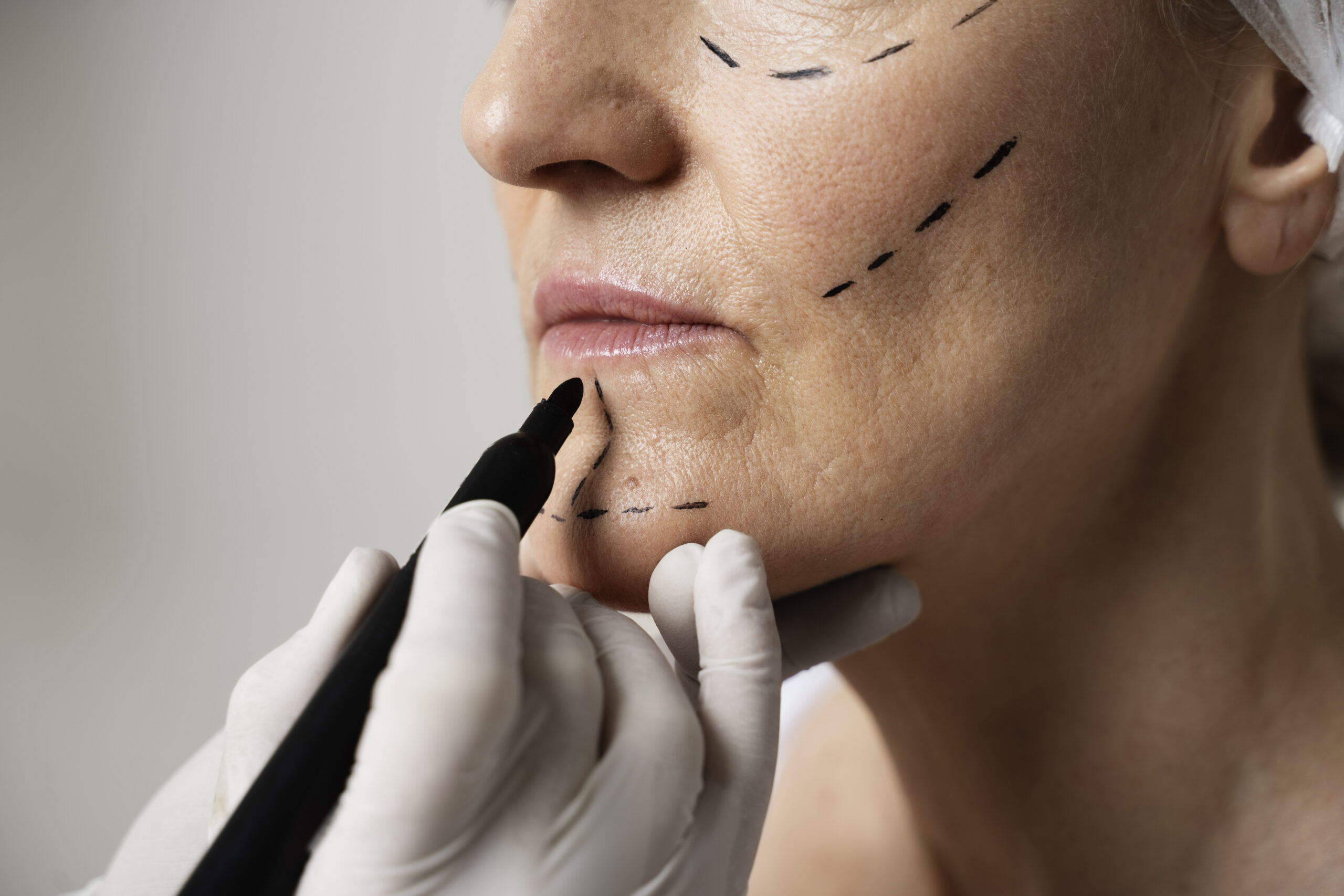 Asthetische Chirurgie In Der Nahe